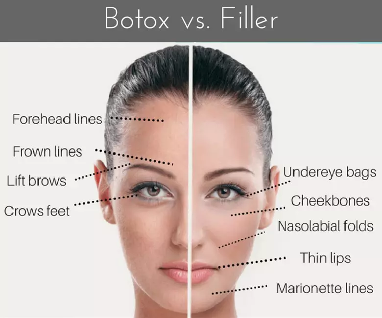 Botox Vs. Fillers : Differences and Uses